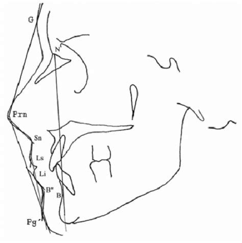Angular Measurements Download Scientific Diagram