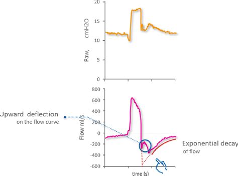 Figure 1 From Using Waveforms To Identify Asynchronies Step 2 Semantic Scholar