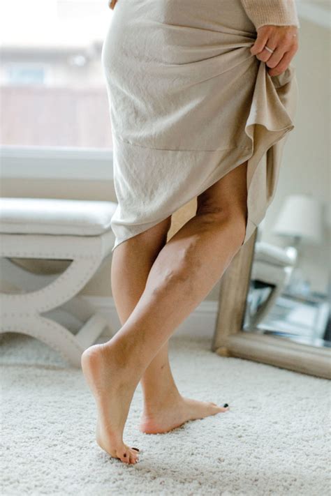 Let S Talk Varicose Veins Gold And Graphite By Jill Atogwe