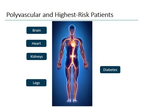 Risk Stratification In Cad And Pad Ppt Download
