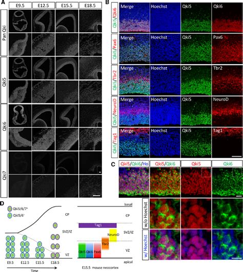 Qki5 And Qki6 Are Expressed In Early Neural Stem Cells Of The