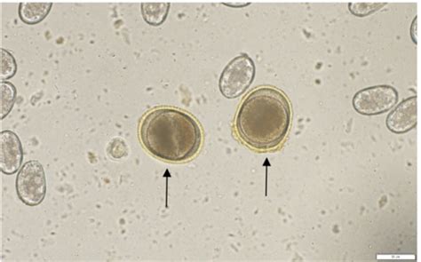 Common Gi Parasites Flashcards Quizlet Common Gi Parasites Flashcards Quizlet
