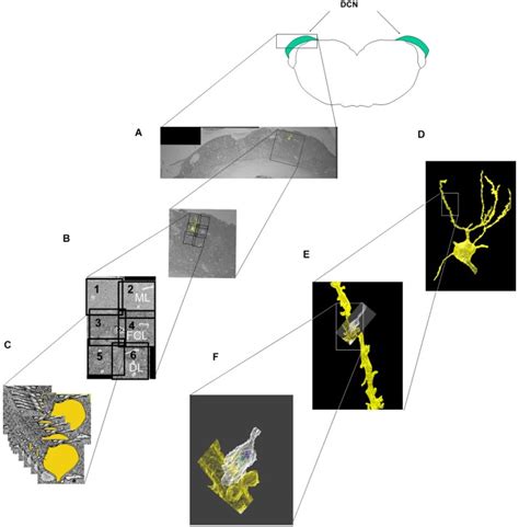 Steps Involved In The Imaging Segmentation And Reconstruction Of