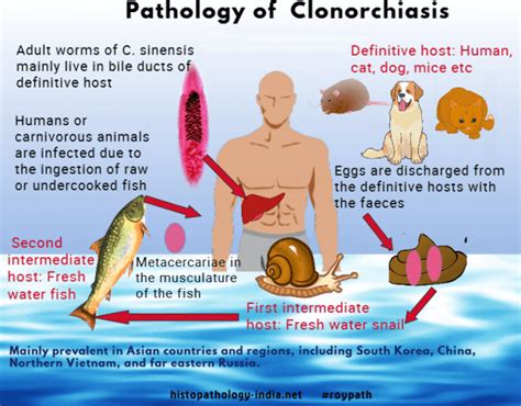 Opisthorchis Sinensis