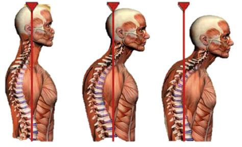 Good Posture Realign First