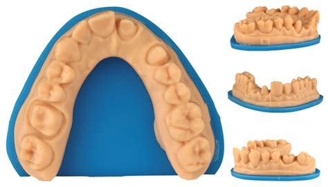Dental Casts For Fixed Dental Prostheses Printed With Sla Technology
