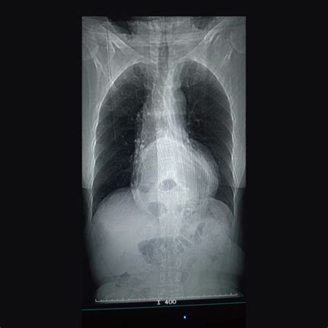 Andreas Sofroniou Posted On Linkedin