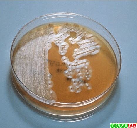 Microbiology Atlas Of Anaerobes Of Clinical Importance Free Medical