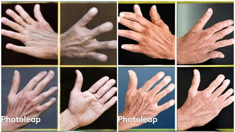 Ai Generated Hands Uncensored By Jason15673 On Deviantart