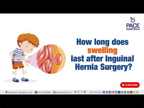 How Long Does Swelling Last After Laparoscopic Inguinal Hernia Surgery
