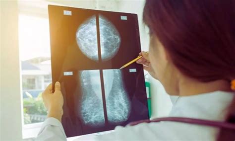 Can Detection Of Breast Arterial Calcification During Mammography Help