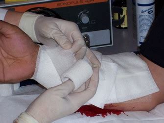 Case Study LOYA Hand Center