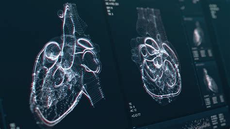 Teleray Rmc Advances Remote Control Modalities Teleray Telehealth