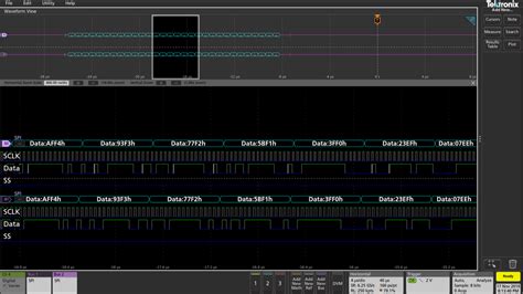 Solved Dma Cannot Read Spi Data Register While Debuging I