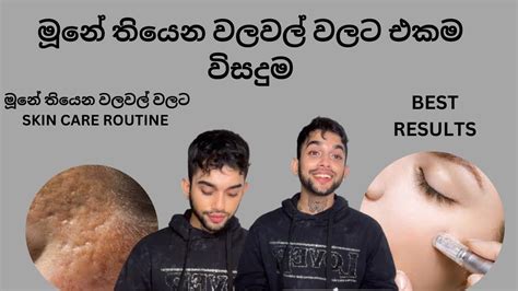 How To Minimize Enlarged Pores Skincare Tips That Actually Work YouTube