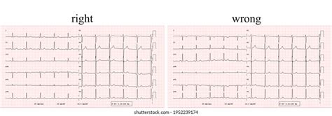 Graphs Signals Transient Analysis Frequency Response Stock Illustration