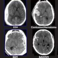 Causes Of Head Injury According To Gender Distribution Download Scientific Diagram