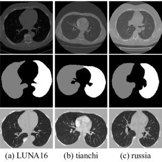 Samples Of Four Pulmonary Nodule Datasets Each Column Belongs To One Download Scientific