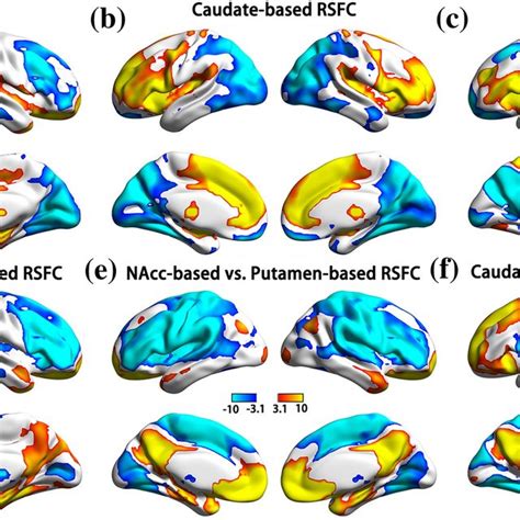 Resting State Functional Networks Related To The Nacc Caudate And Download Scientific