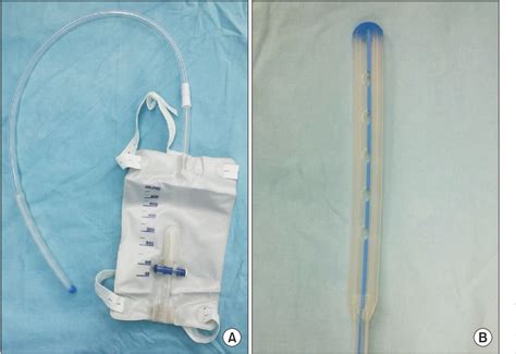 Figure 1 From Comparative Study Between Transanal Tube And Loop Ileostomy In Low Anterior
