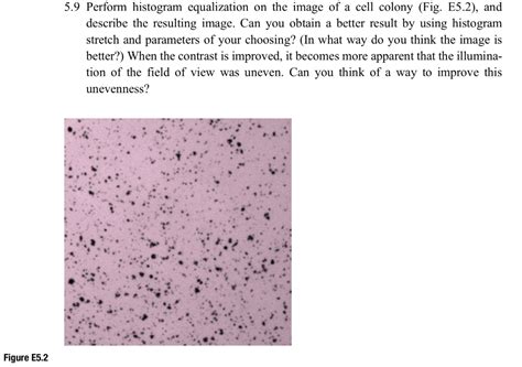 Perform Histogram Equalization On The Image Of A Chegg