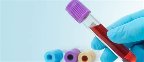 Biometría Hemática Completa Diagnostico Medico A Domicilio