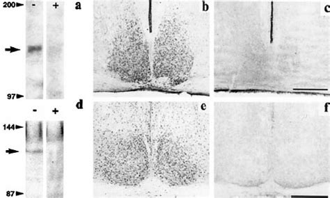 Nuclear Localization Of Mper1 And Mtim In Mouse Forebrain And