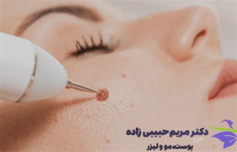 خال عفونی آیا خال عفونت می‌کند؟ دکتر مریم حبیبی زاده