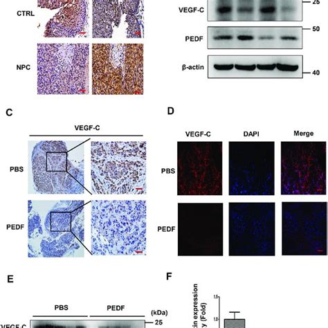 Graphical Classification Of Coding And Regulatory Non Coding Rnas In A