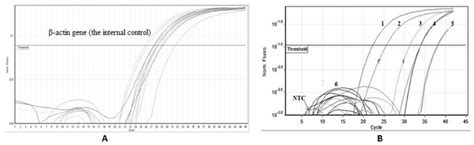 Real Time Pcr Based Detection Gbs In Rectalvaginal Specimens Collected