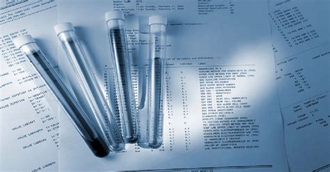 Compunet Clinical Laboratories On Linkedin Specimen Processor Miami Valley Hospital In Dayton Oh