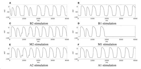 Patient 1 A F Transmembrane Potential Waveforms In The Six Download Scientific Diagram