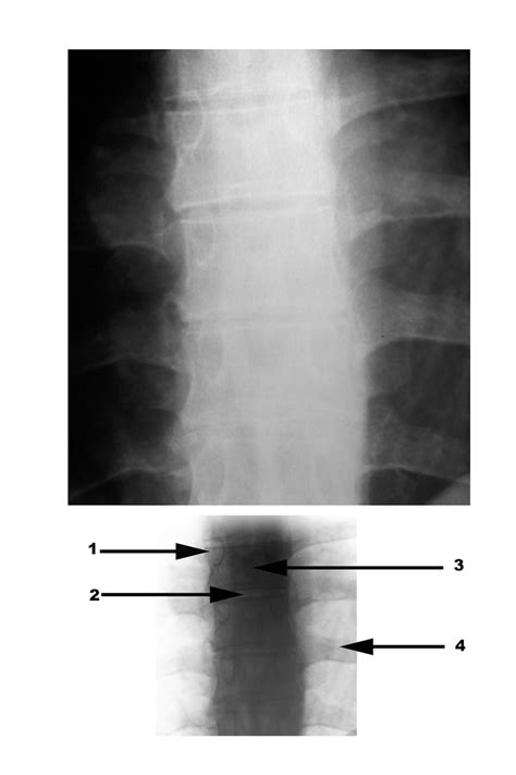 Chapter 27 Radiography Orthogate Press