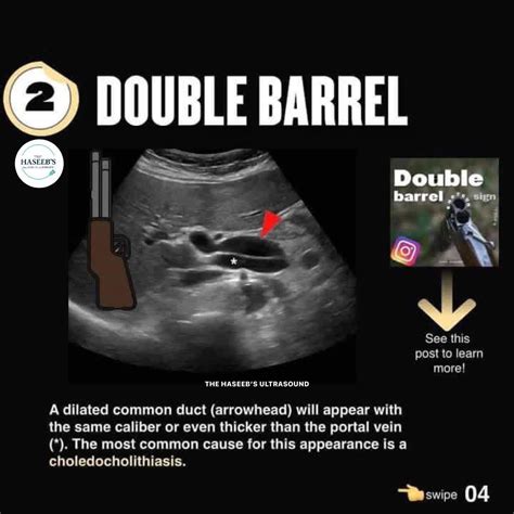 Mastering Ultrasound