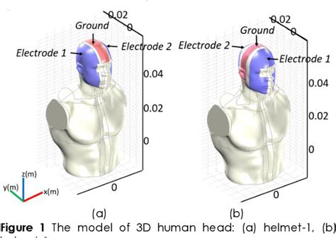 Figure 1 From Wire Mesh Capacitance Tomography For Treatment Planning System Of Electro