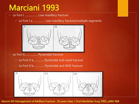 Classificationfacialfracturekamini 200801184051pptx