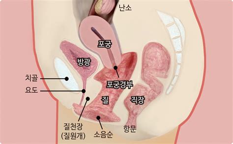 월경컵tmi