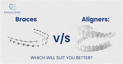 Braces Vs Aligners Which Will Suit You Better Robstown Smiles