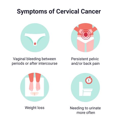 Cervical Cancer Symptoms And Treatment Aurora Health Care