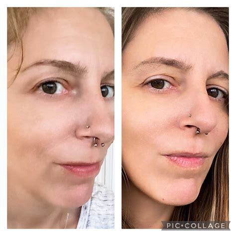 The Difference Between An Incorrectly Placed Septum Piercing And A