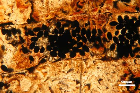 Tapeworm Segments In Human Stool
