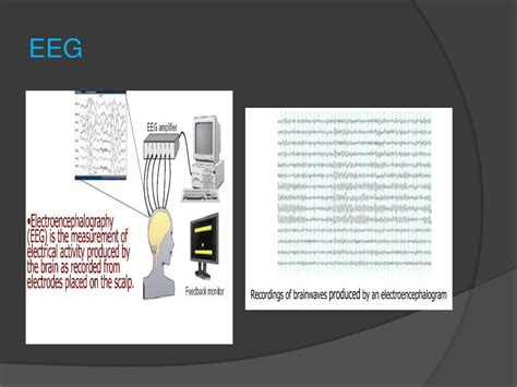 PPT BRAIN COMPUTER INTERFACE BCI PowerPoint Presentation Free Download ID