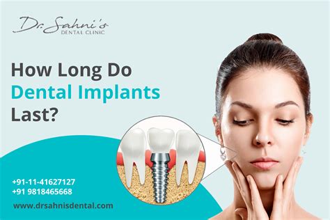 Do Dental Implants Last Forever How Long Do Dental Implants Last