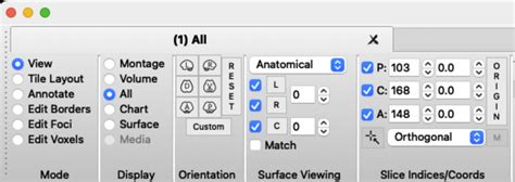 How To Inspect Surface Data Caroline Nettekoven