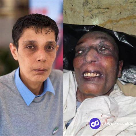 عکس کشف جسد مازن حماده افشاگر مشهور سوری در زندان مخوف صیدنایا