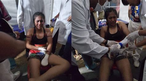 ទូច ចាន់វត្តី បារម្ភមិនអាចមានសមត្ថភាពដូចដើម ខណៈត្រូវការពេល៦ខែ ព្យាបាលរបួសបាក់ដៃ