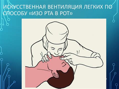 Техника первой доврачебной помощи непрямой массаж сердца искусственная вентиляция легких по