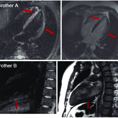 Three Dimensional Retrospective Image Based Motion Correction Trim Download Scientific