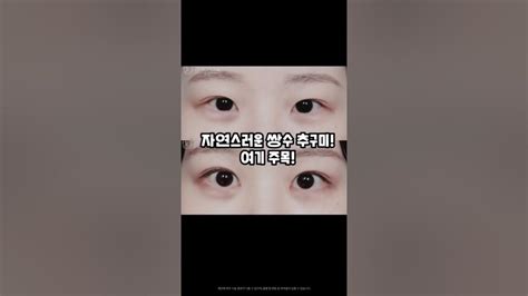자연스러운 쌍수 추구미 여기 주목제로원성형외과눈성형눈수술쌍수쌍꺼풀속쌍인라인인아웃라인눈성형후기눈성형전후쌍수후기