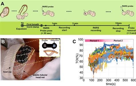 Recording Procedures A Experimental Protocol B Set Up For